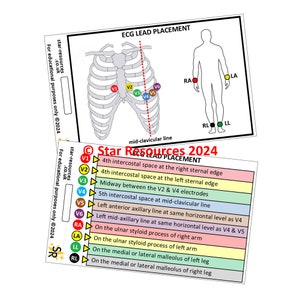 ECG Lead Placement ID Badge Flash Cards Student Paramedics Ambulance - Etsy