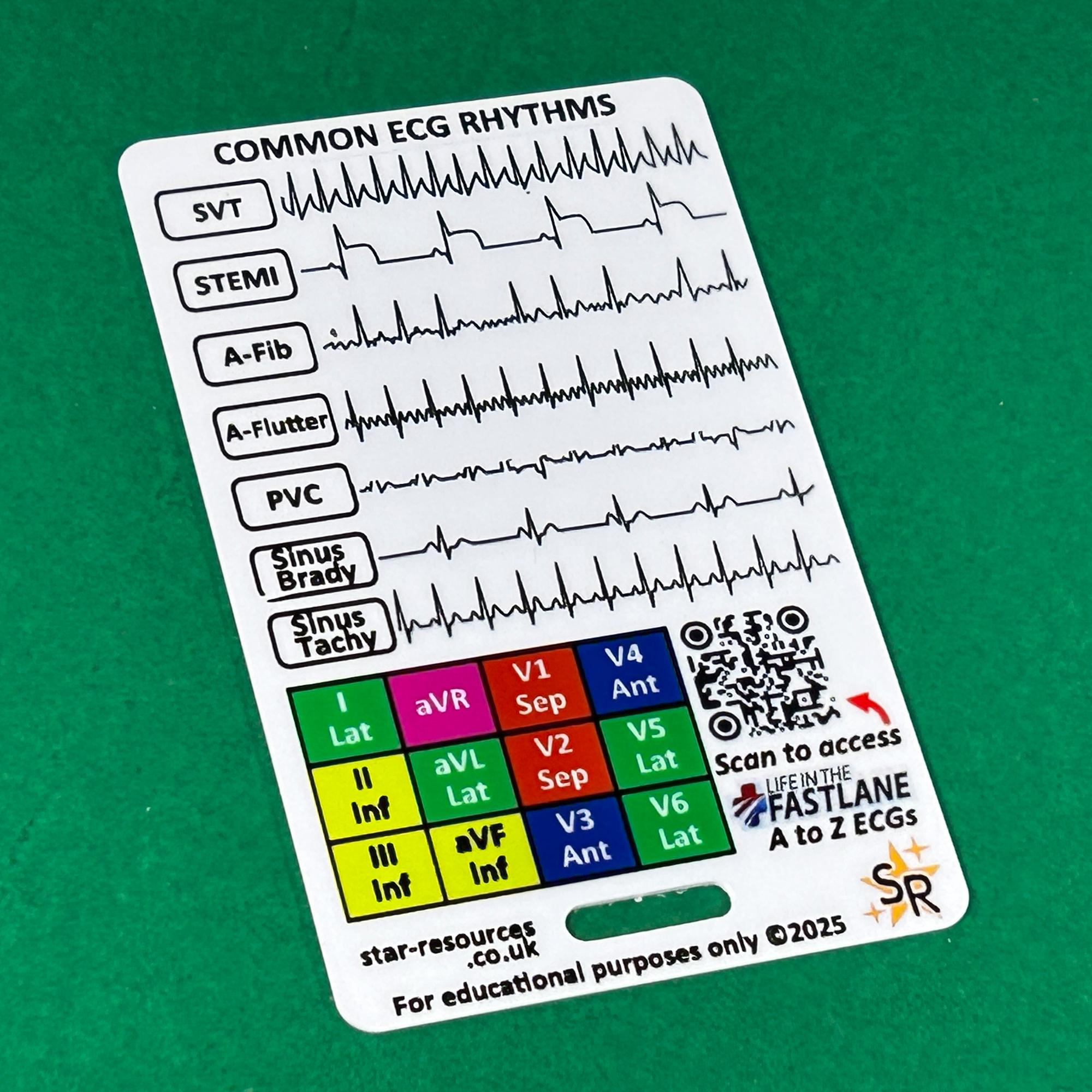ECG Rhythms ID Badge Flash Cards Student Paramedics Ambulance - Etsy UK