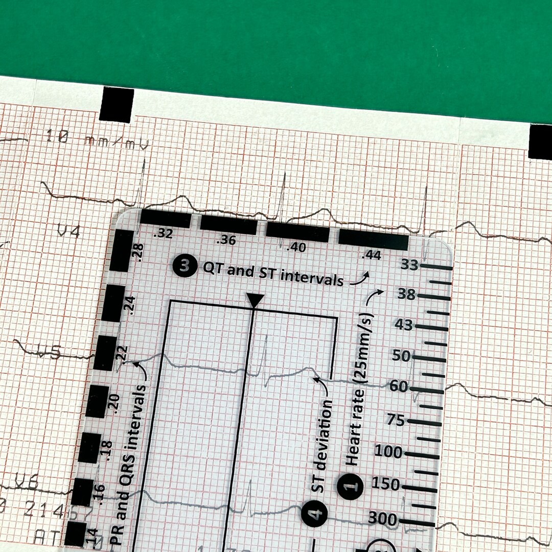 ECG Reader ID Badge Flash Cards Student Paramedics Ambulance Medical ...