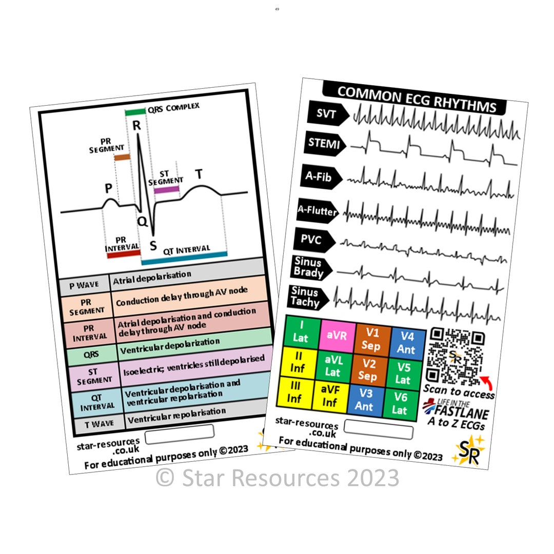 ECG Rhythms ID Badge Flash Cards Student Paramedics Ambulance - Etsy UK