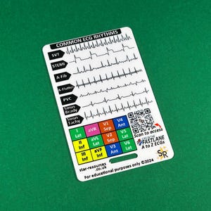 ECG Rhythms ID Badge Flash Cards Student Paramedics Ambulance - Etsy UK