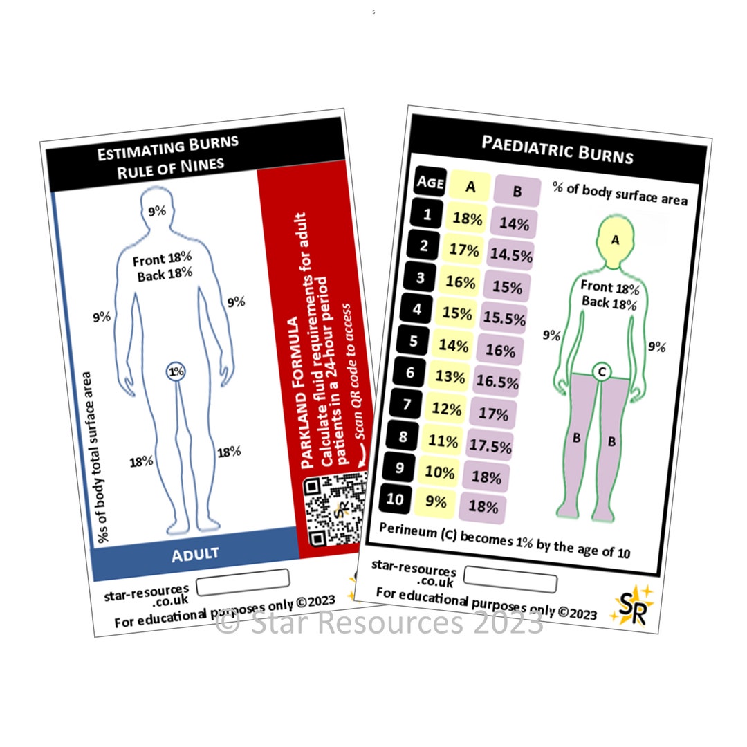 Rule of Nine Burns ID Badge Flash Card Student Nurse Paramedics ...