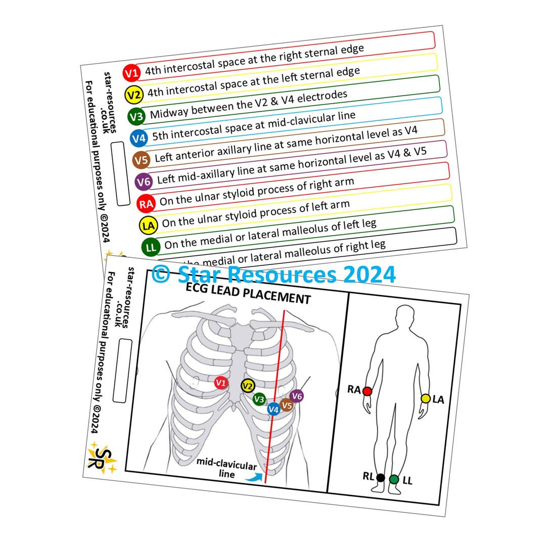 ECG Lead Placement ID Badge Flash Cards Student Paramedics Ambulance - Etsy