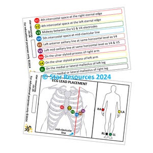 ECG Lead Placement ID Badge Flash Cards Student Paramedics Ambulance ...