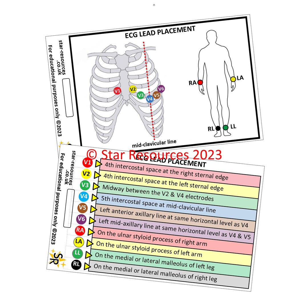 ECG Lead Placement ID Badge Flash Cards Student Paramedics Ambulance - Etsy