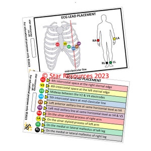 ECG Lead Placement ID Badge Flash Cards Student Paramedics - Etsy UK