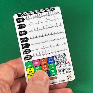 ECG Rhythms ID Badge Flash Cards Student Paramedics Ambulance - Etsy Australia