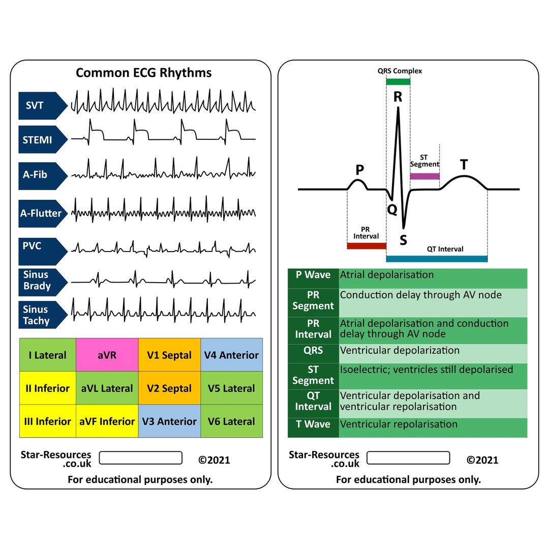 ECG ID Badge Flash Cards Student Paramedics Ambulance - Etsy