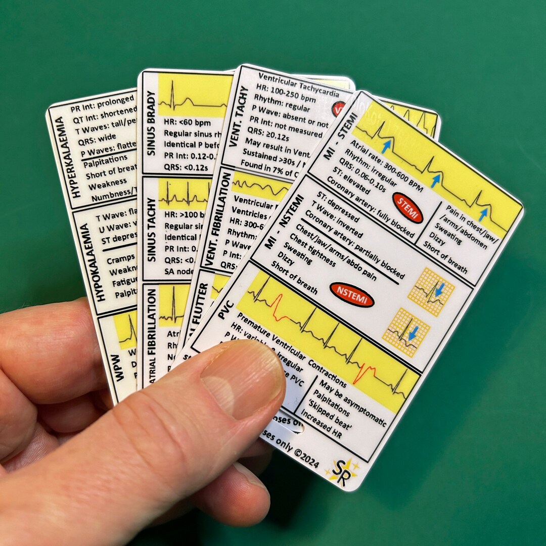 ECG Reference ID Badge Flash Cards Student Paramedics Ambulance - Etsy UK