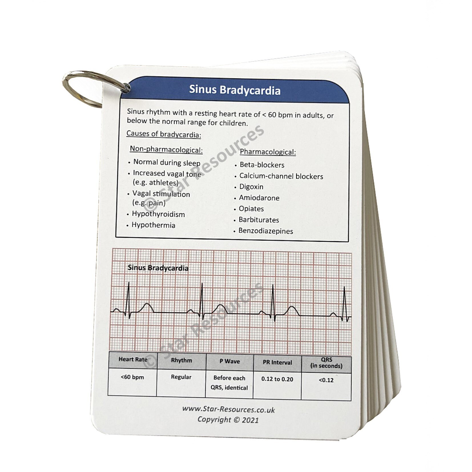 ECG Revision FlashCards on Metal Ring Flash Cards Student | Etsy