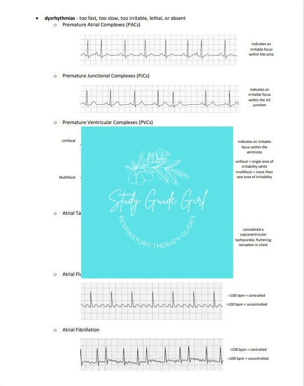Study Guide - Electrocardiogram (EKG/ECG) - PDF Download - Etsy