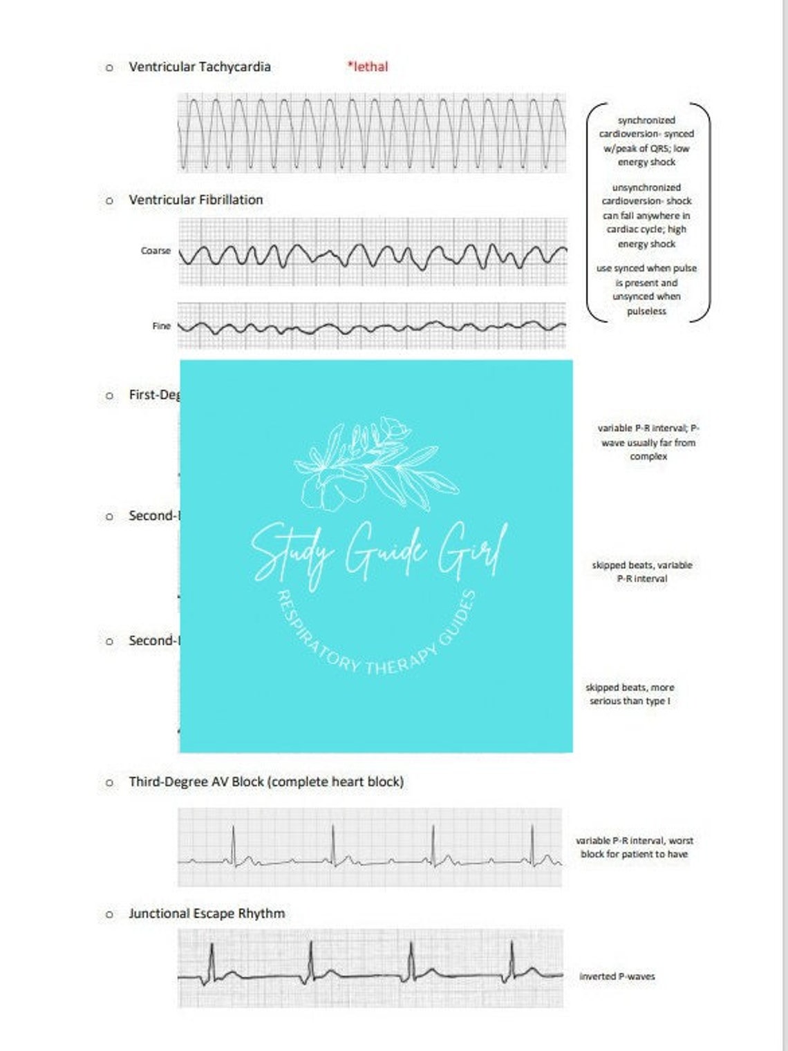 Study Guide - Electrocardiogram (EKG/ECG) - PDF Download - Etsy