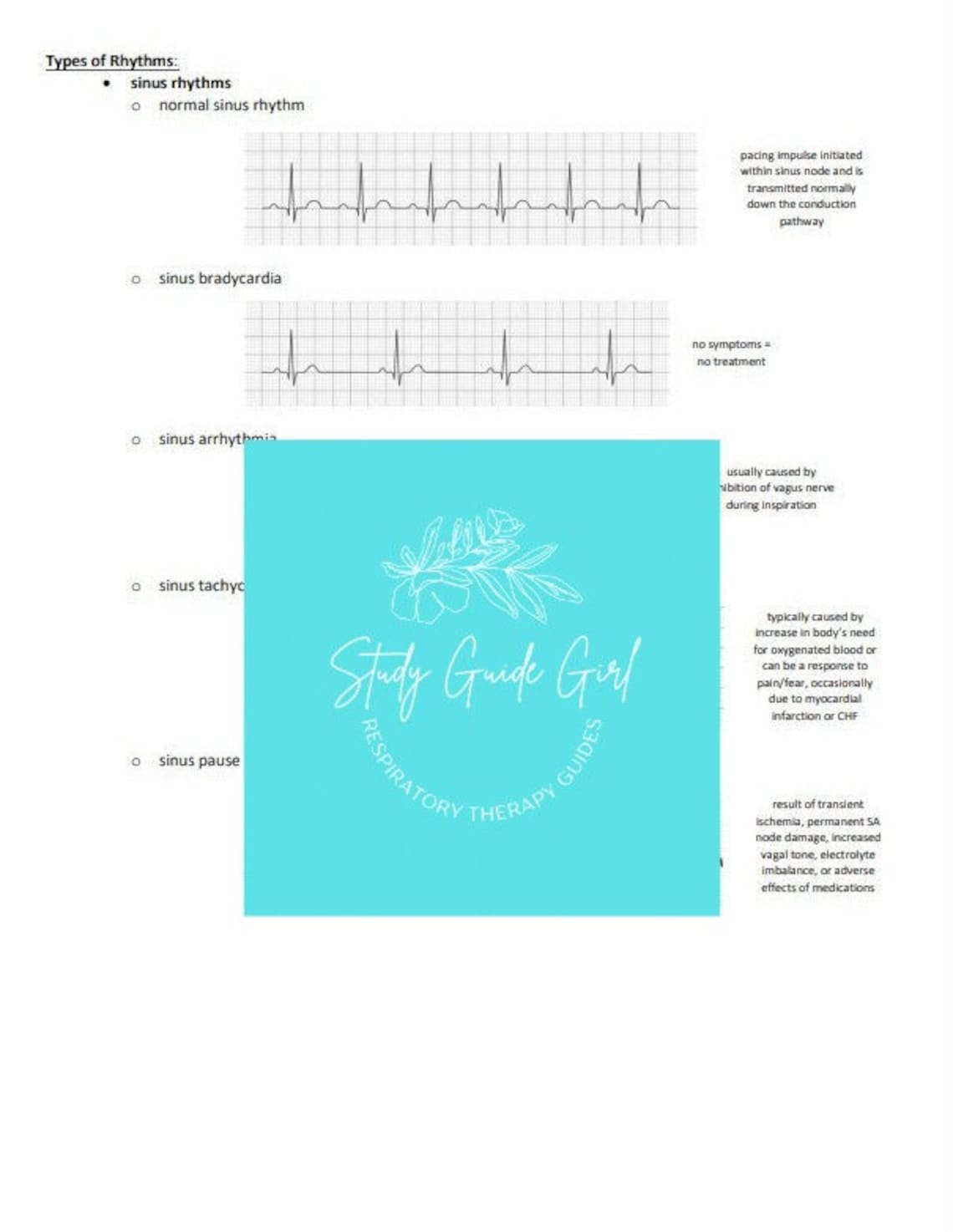 Study Guide - Electrocardiogram (EKG/ECG) - PDF Download - Etsy