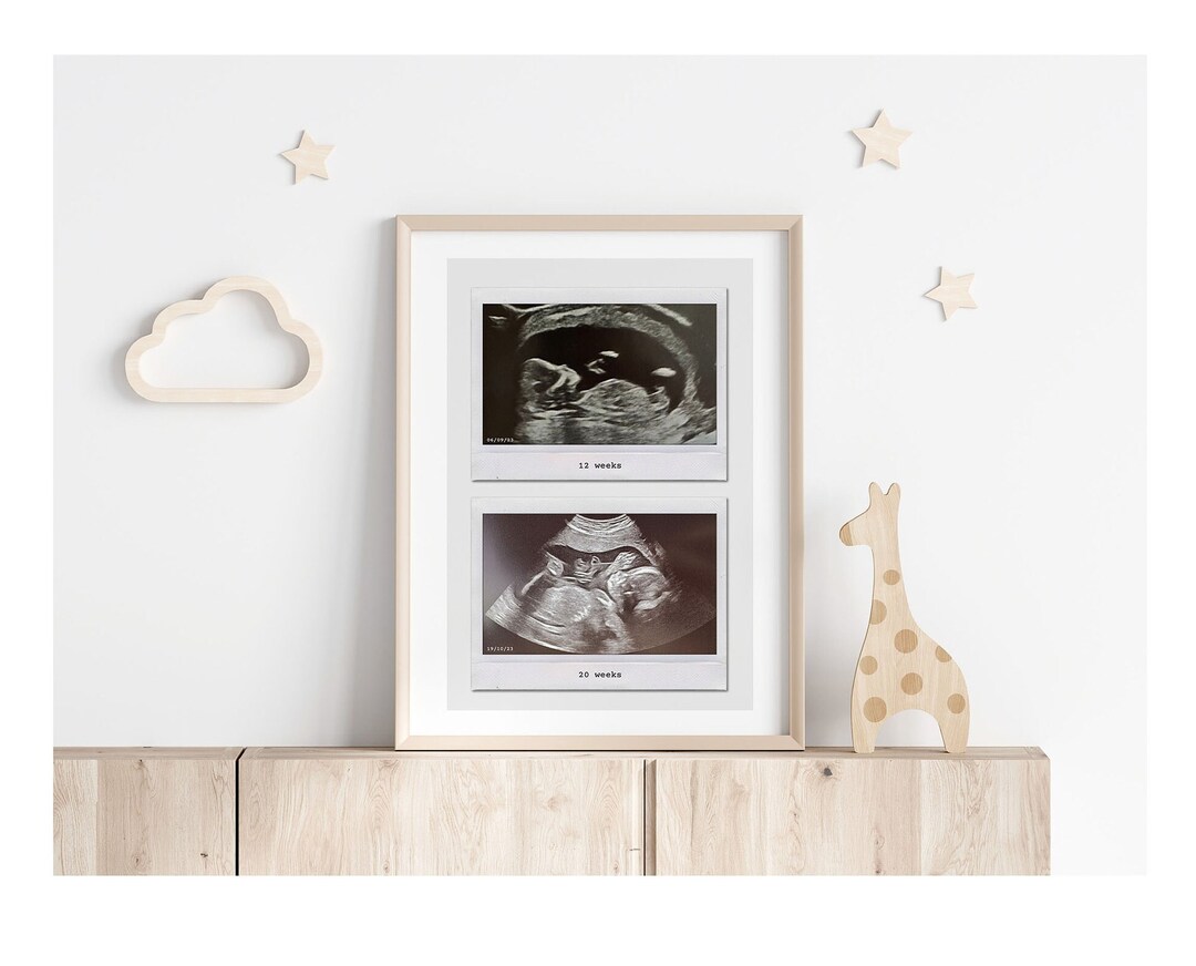 Baby Scan Print Ultrasound Keepsake Print 12 & 20 Week Baby Scan Print ...