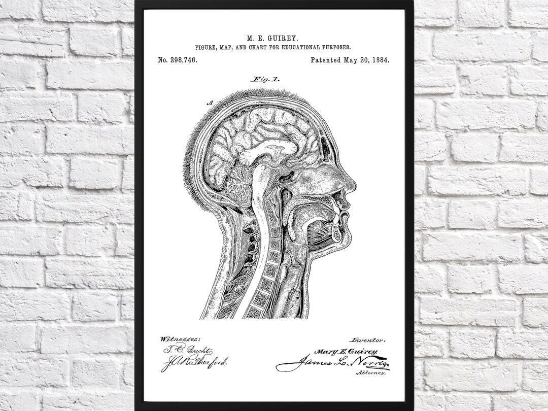 Head Chart Brain Map Patent Print, Printable Home Wall Art, Medical ...