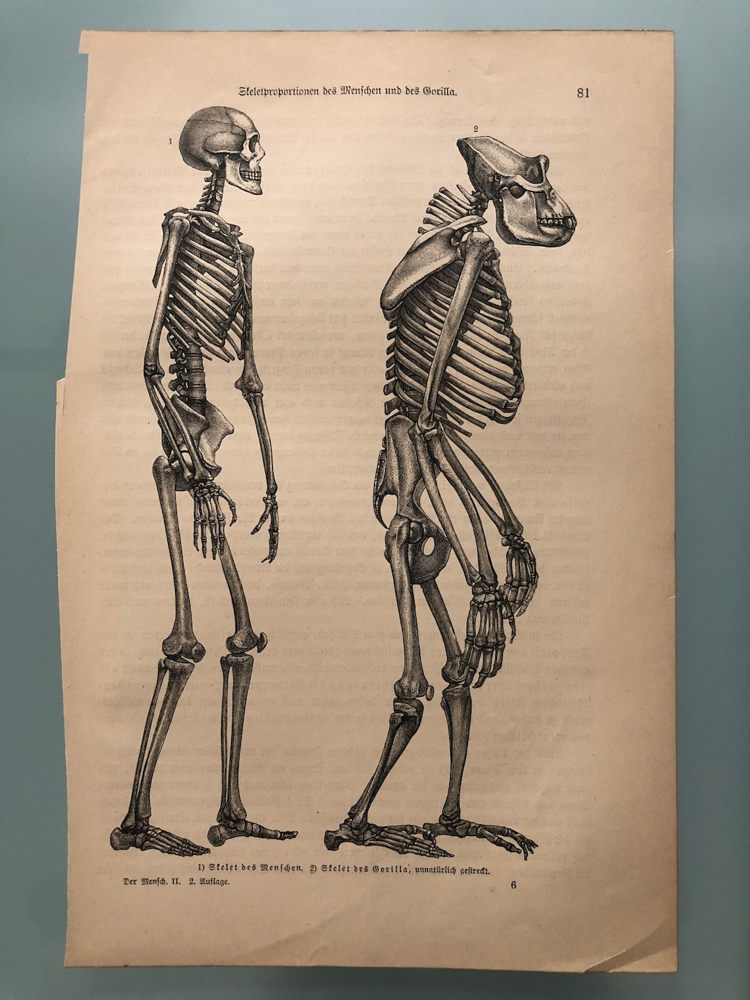 HUMAN and GORILLA SKELETONS - Original From “der Mensch”- Circa 1887 - Etsy