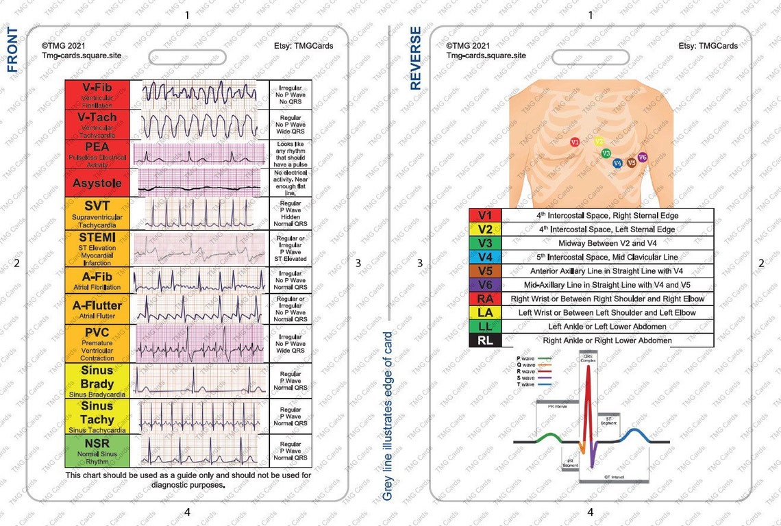 ECG Healthcare Nursing Medical Pocket Card | Etsy