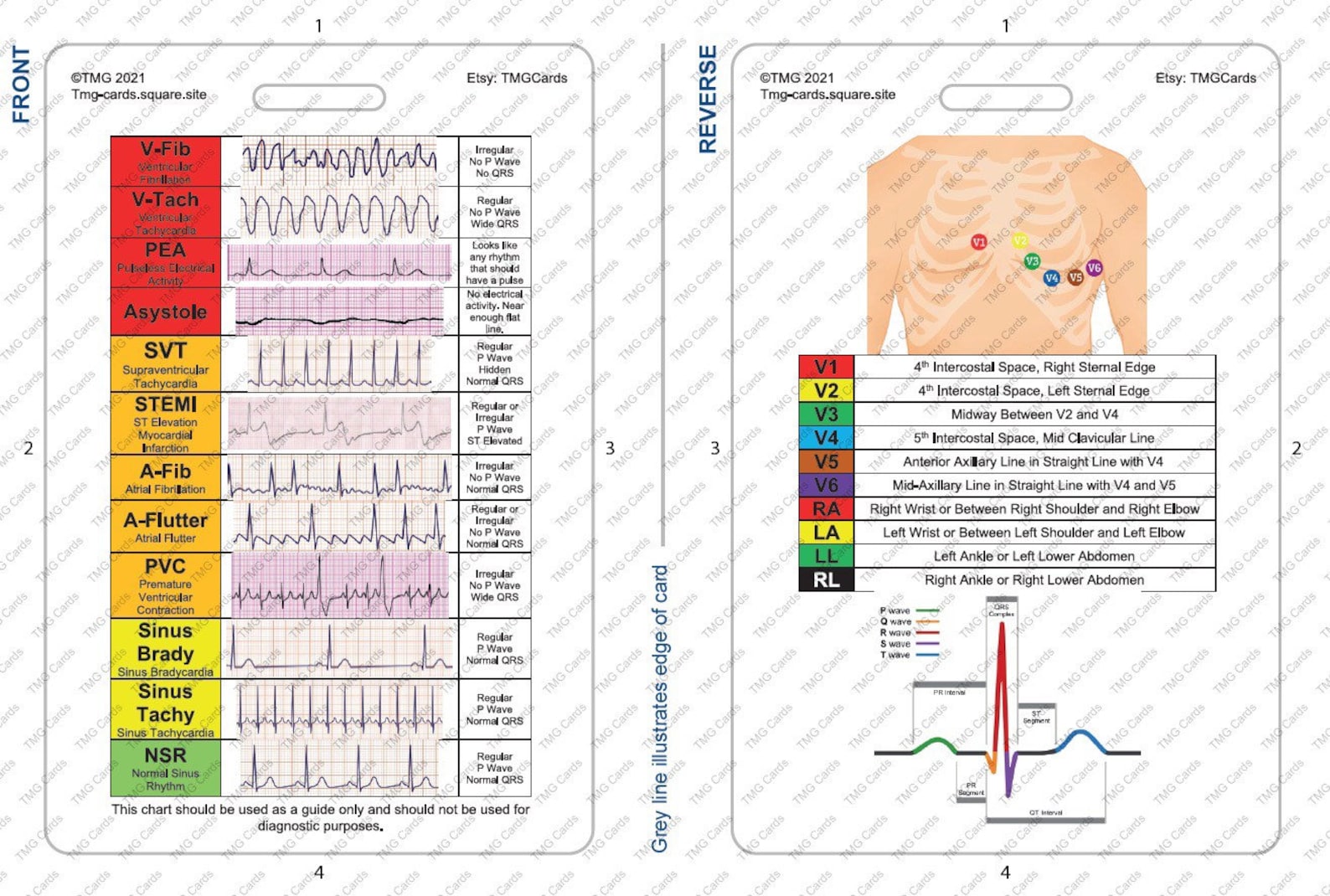 ECG Healthcare Nursing Medical Pocket Card | Etsy
