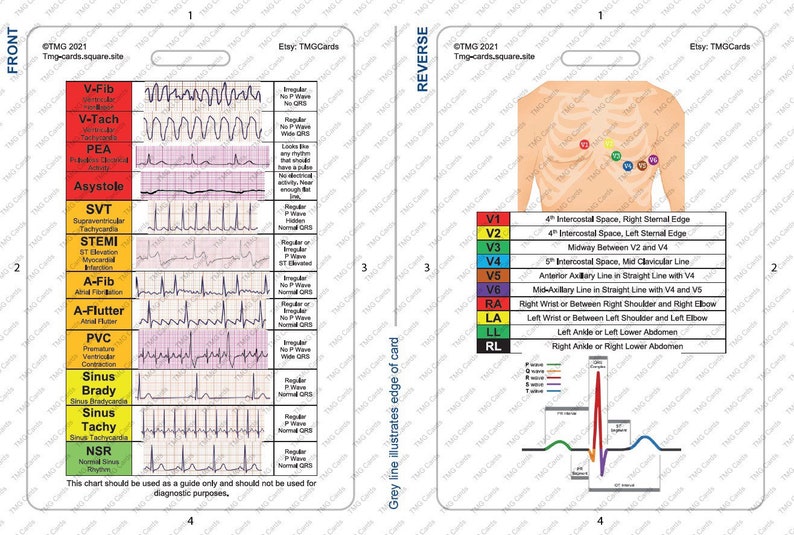 ECG Healthcare Nursing Medical Pocket Card | Etsy