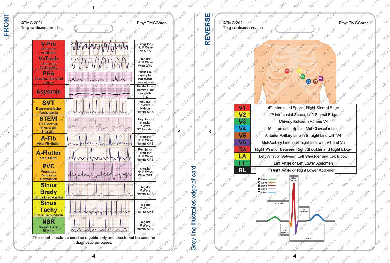 ECG Healthcare Nursing Medical Pocket Card | Etsy