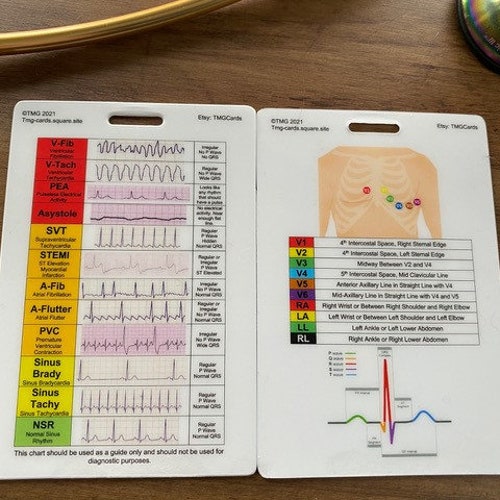 ECG Healthcare Nursing Medical Pocket Card - Etsy