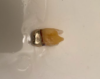 Real Human Teeth Necklace | Etsy