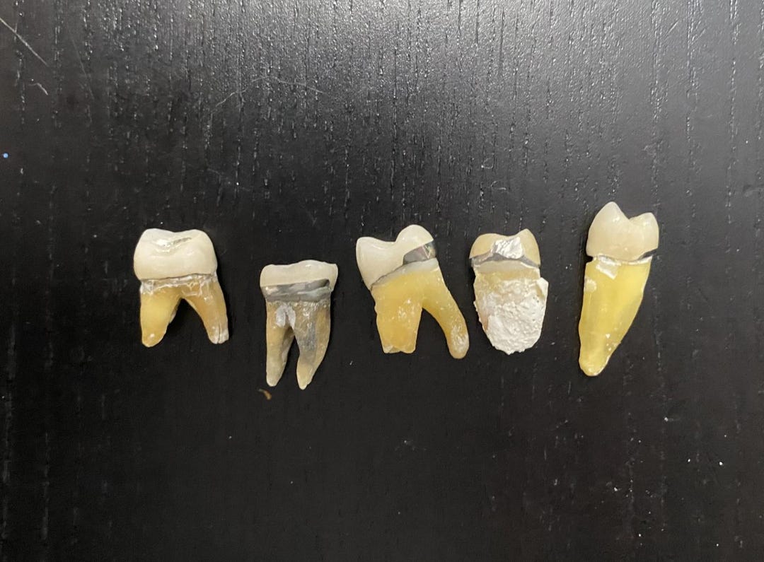 5 Real Human Teeth WITH CROWNS - Etsy