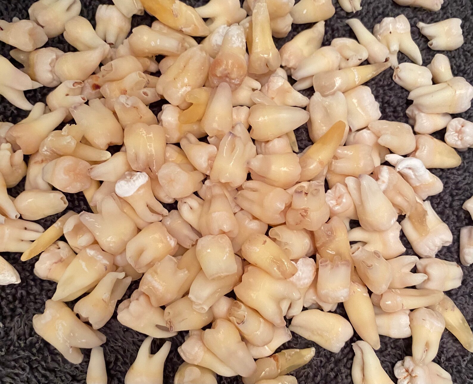 10 Real Human Teeth (molars, Premolars, & Anteriors) - Etsy