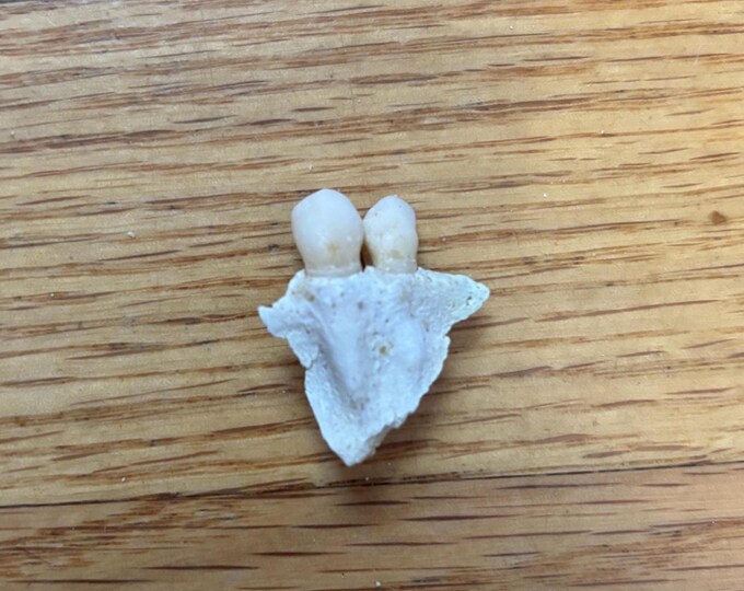 RARE Two Human Teeth Together in Bone (one Item) - Etsy