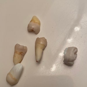 10 CRACKED AND BROKEN Real Human Teeth Shards Molars - Etsy