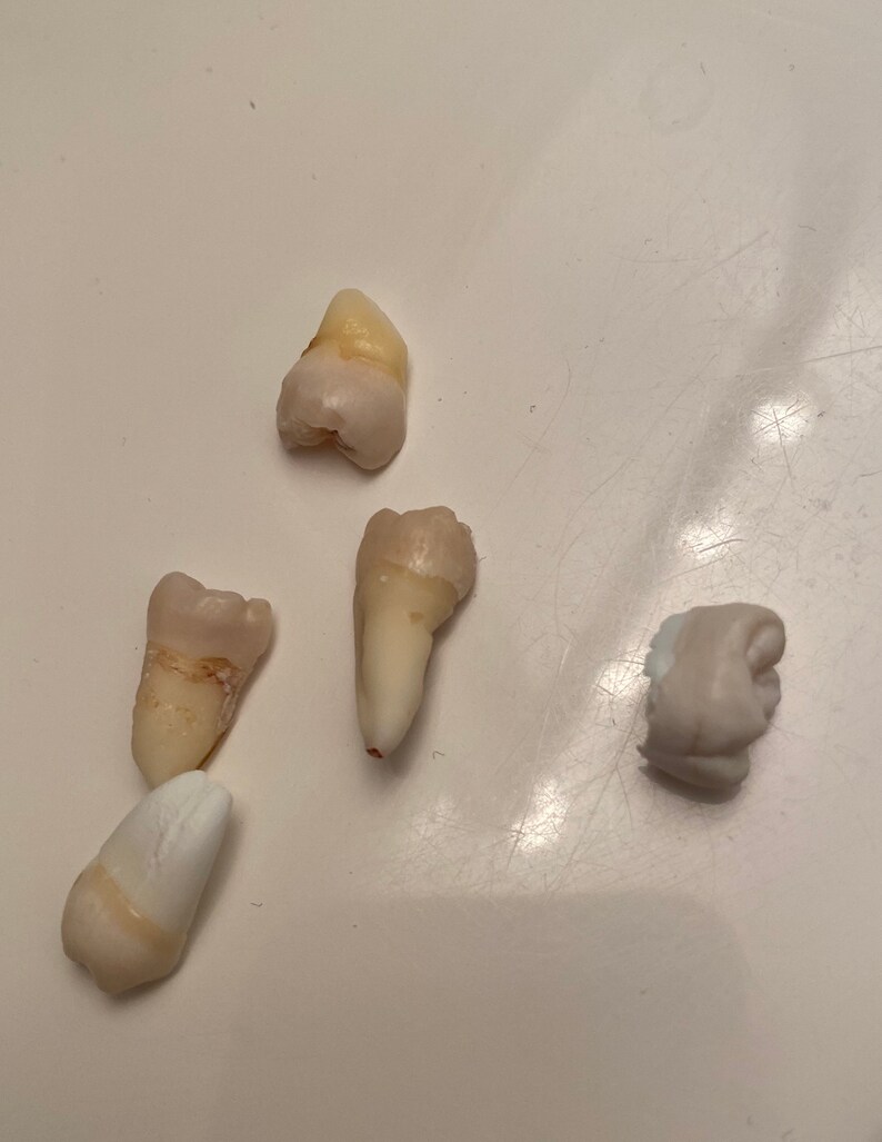 10 CRACKED AND BROKEN Real Human Teeth Shards Molars - Etsy