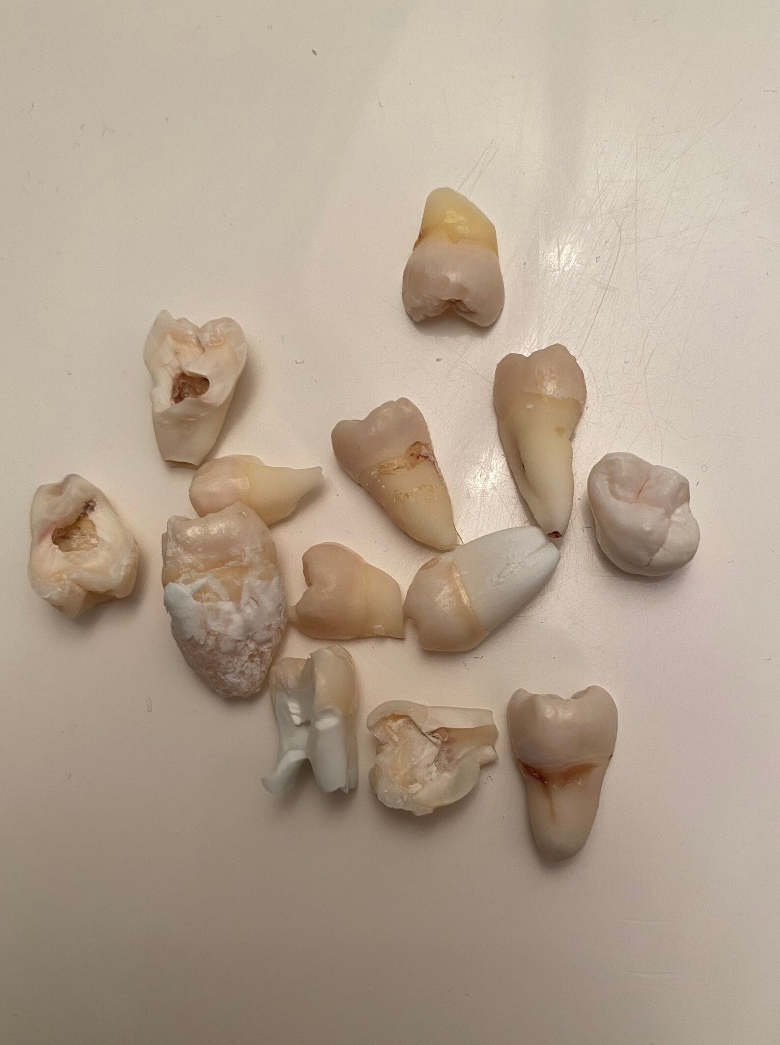 10 CRACKED AND BROKEN Real Human Teeth Shards Molars - Etsy