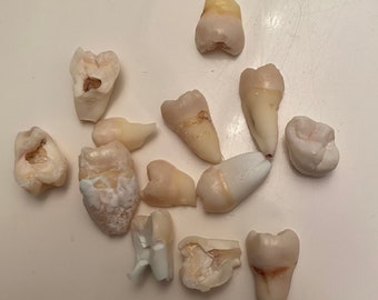 5 Real Human Teeth Molars Premolars & Anteriors - Etsy