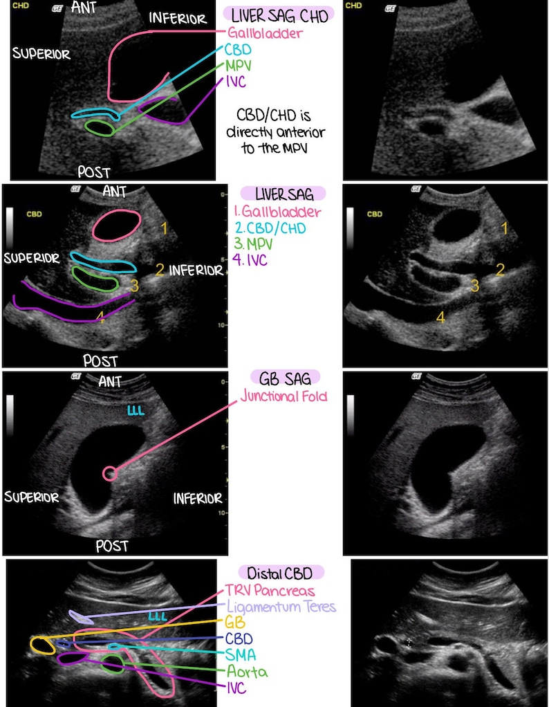 Liver Ultrasound DOWNLOAD Lecture Notes PDF Ultrasound School for ...