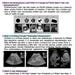 Abdomen Ultrasound Study Guides DOWNLOAD PDF Ultrasound School for ...