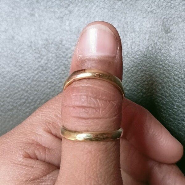 Arthritis Ring - Etsy