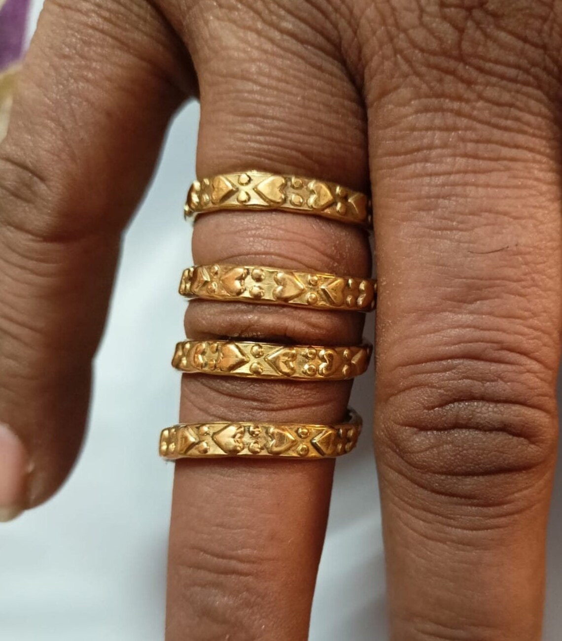 EDS Finger Splint Rings Mallet Finger Ring Trigger Finger | Etsy