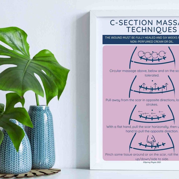 Pelvic Floor Anatomy Model - Etsy