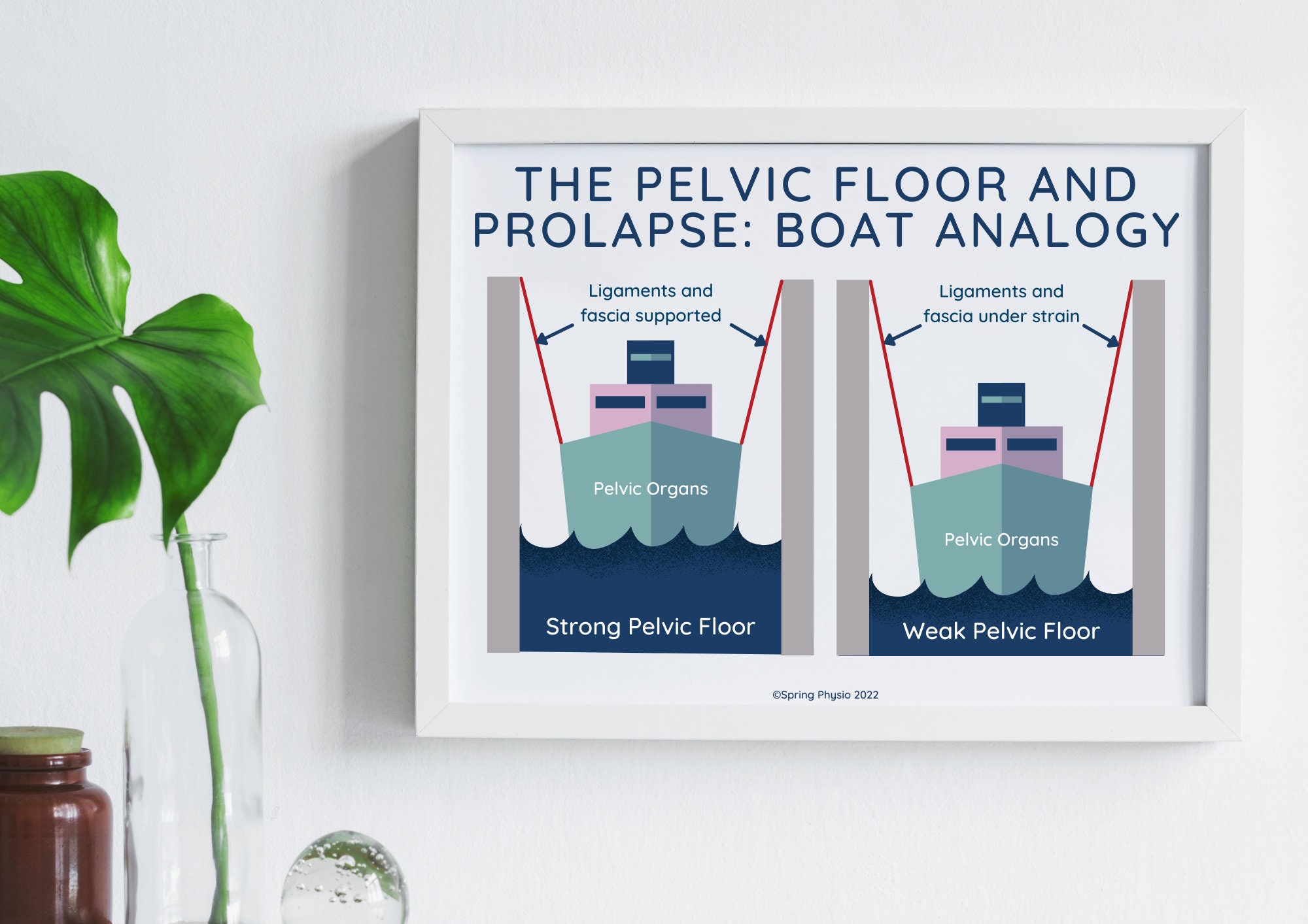 Pelvic Floor Physical Therapist Poster | Pelvic Floor and Prolapse ...