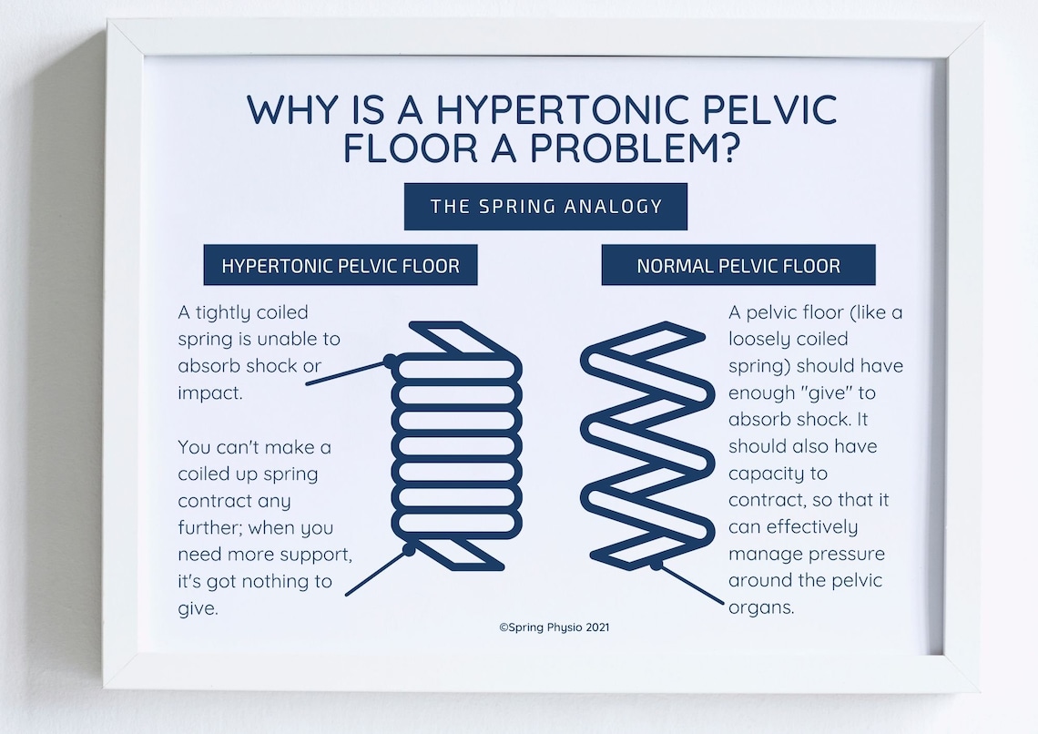 Hypertonic Pelvic Floor | Pelvic Floor Art | Pelvic Floor Poster - Etsy