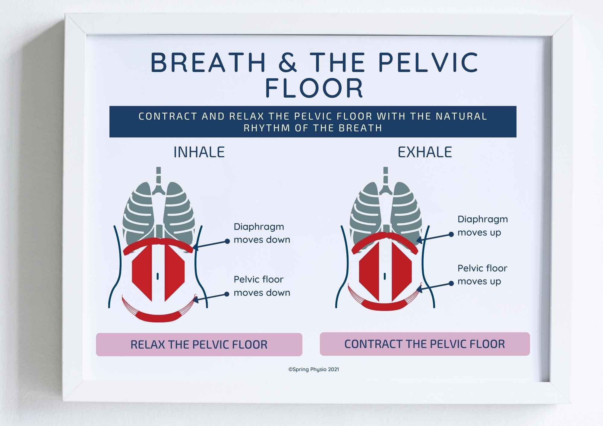 Physical Therapy Pelvic Floor Poster | Pelvic Floor Physical Therapy ...