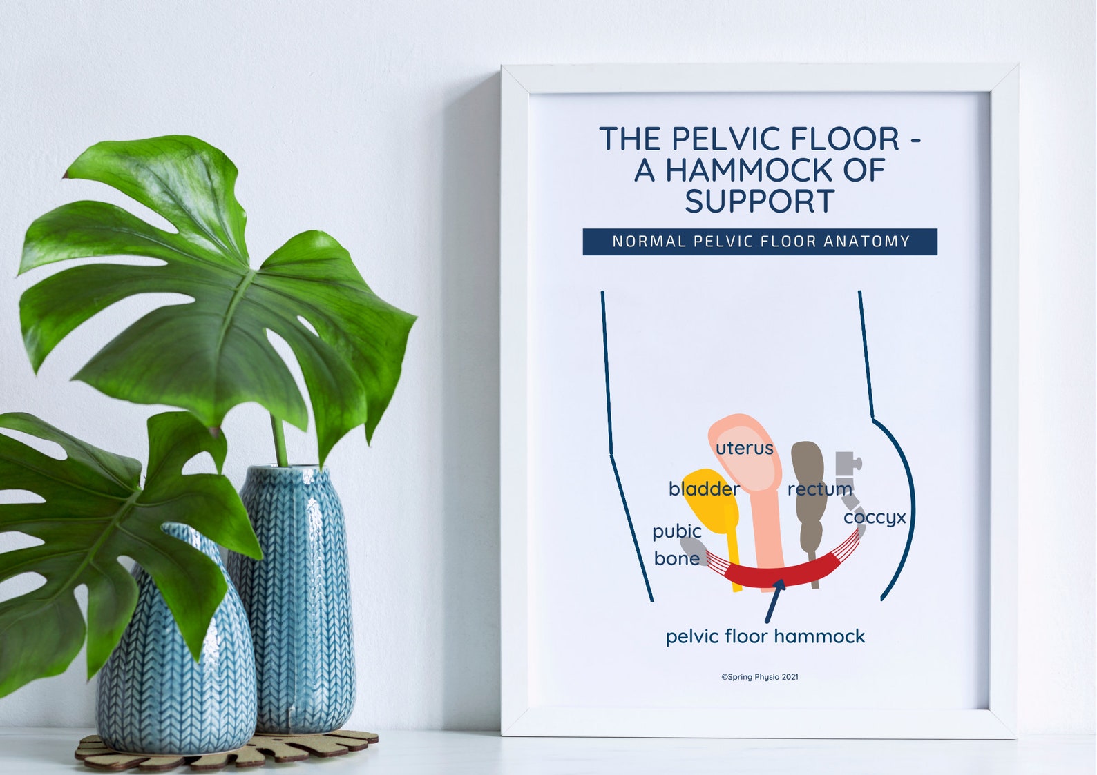 Pelvic Floor Poster Bundle of 3 Prints | Pelvic Floor Art | Pelvic ...
