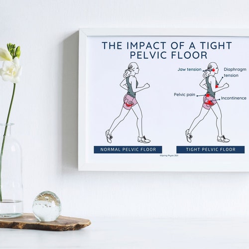Physical Therapy Pelvic Floor Poster Pelvic Floor Physical - Etsy