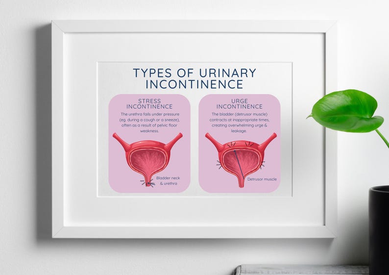 Bladder Poster | Pelvic Floor Poster | Urinary Incontince Education ...