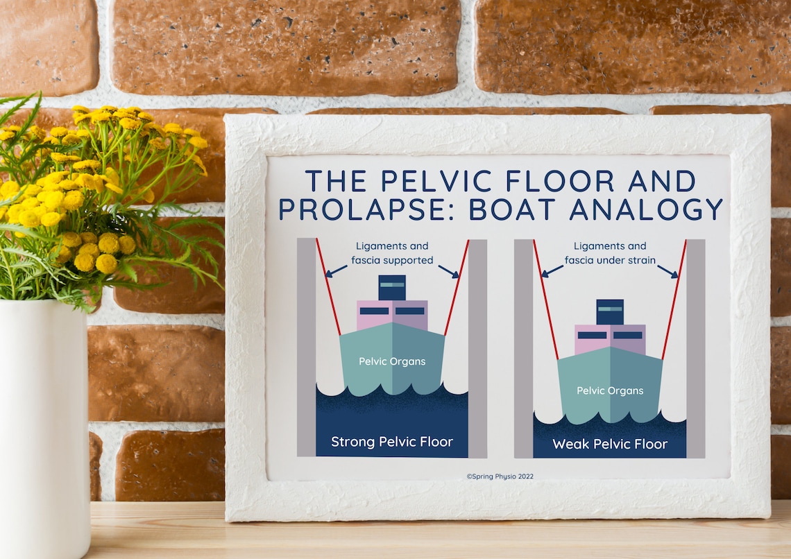 Pelvic Floor Physical Therapist Poster Pelvic Floor and - Etsy