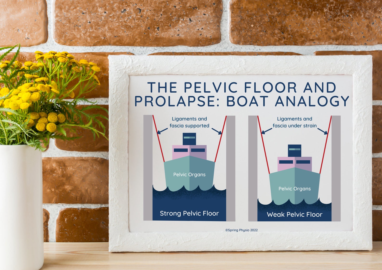 Pelvic Floor Physical Therapist Poster Pelvic Floor and - Etsy