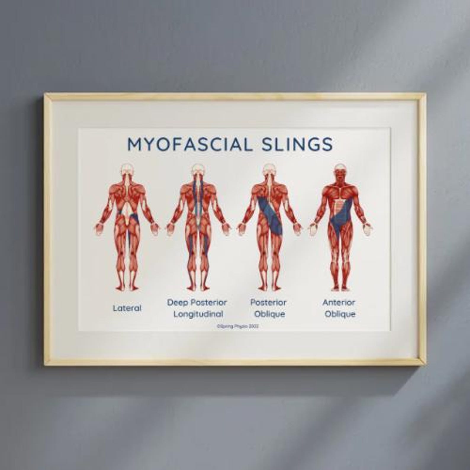 Myofascial Muscle Poster Print for Physical Therapists | Human Anatomy ...