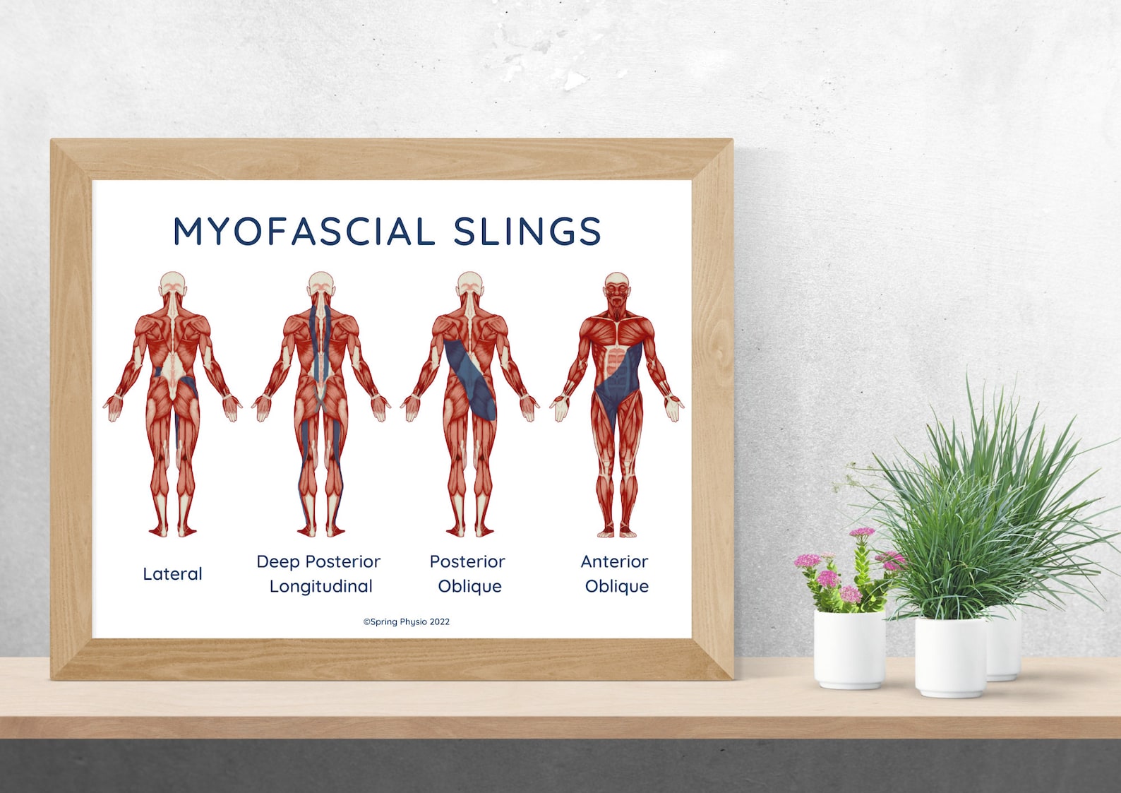 Myofascial Muscle Poster Print for Physical Therapists | Human Anatomy ...