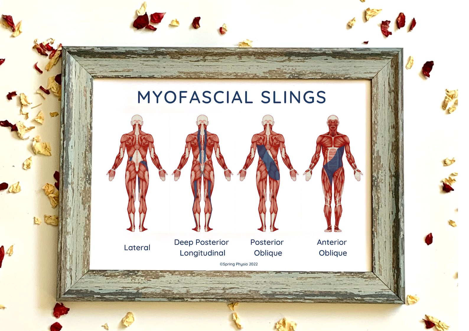 Myofascial Muscle Poster Print for Physical Therapists | Human Anatomy ...