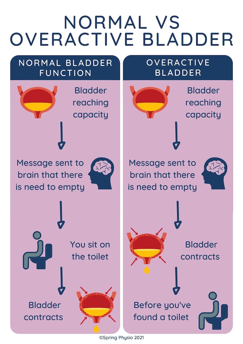 Normal Vs Overactive Bladder Poster | Pelvic Floor Art (digital ...